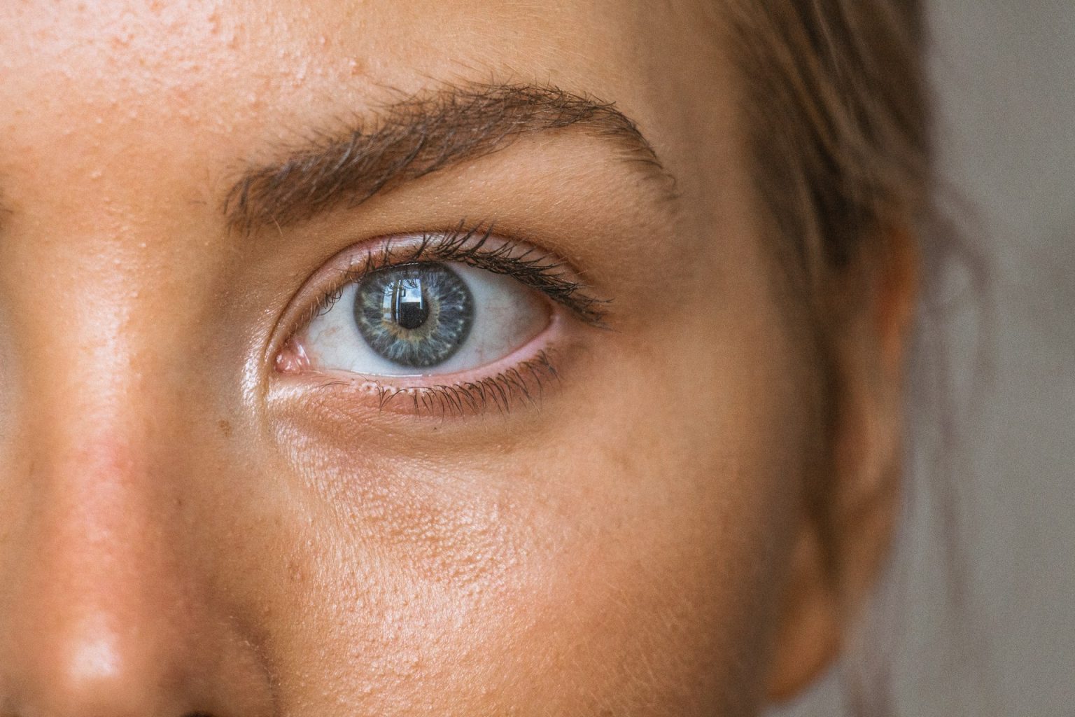What Causes Swelling Under One Eye? Common Reasons